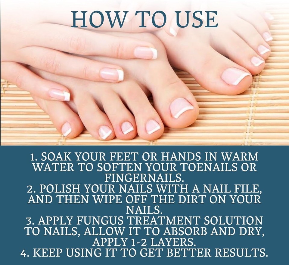 Fungal Nail Treatment - Extra Strong Nail Fungus Treatment for Toenail ...