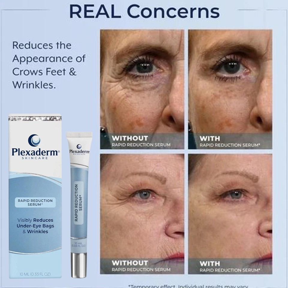 Plexaderm Rapid Reduction Eye Serum - Visibly Reduces Under-Eye Bags ...