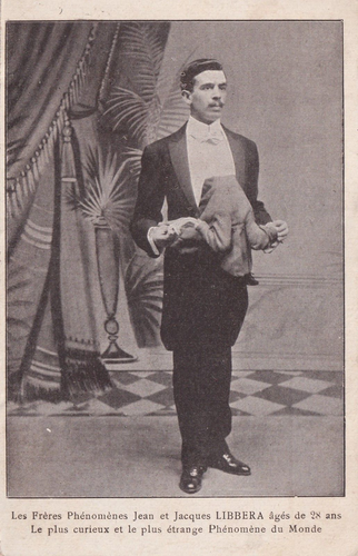 Phenomenon Human. Human Phenomenon. Jean Libbera .twin Parasite Freak ...