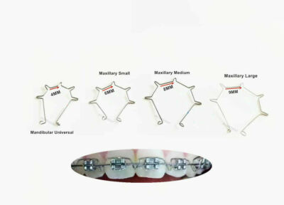 Dental ART Root Torque Spring Spring 5 Loops Curved Anterior Upper ...