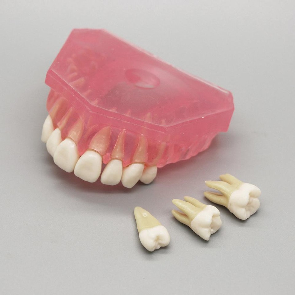 Dental Teeth Model Study Teach Standard Model with Removable Teeth ...