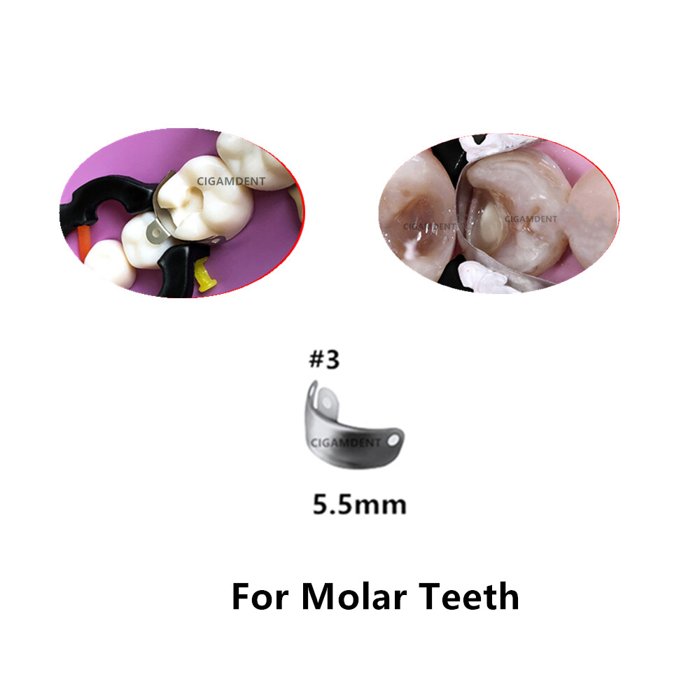 Automatrix Dental Matrix Band Ring Sectional Contoured Matrice ...