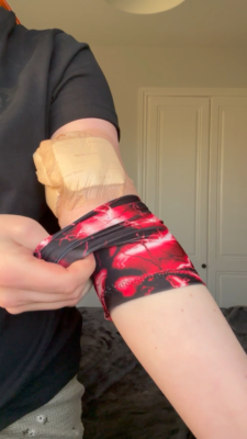 Fistula Tattoos