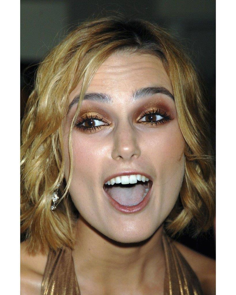 Keira Knightley Teeth Before And After