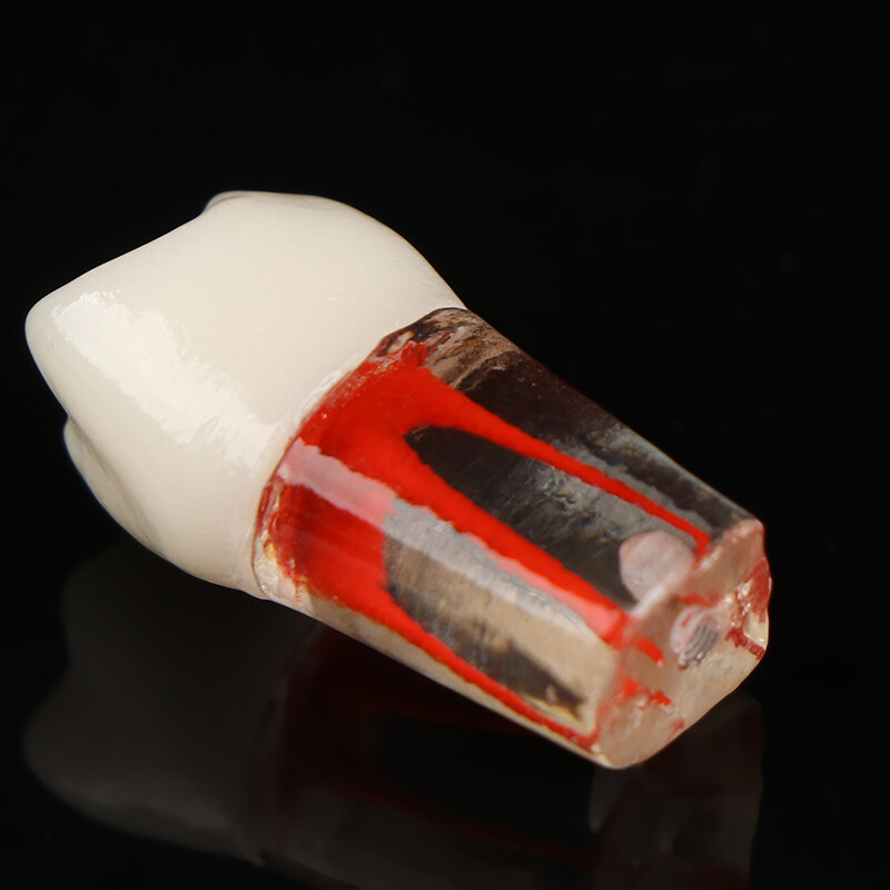 1X Resin Dental Endodontic Tooth Model With Colored Root Canal And Pulp ...