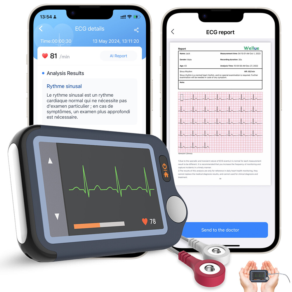 Heart Rhythm Monitor Smartphones FDA Approves First Smartphone