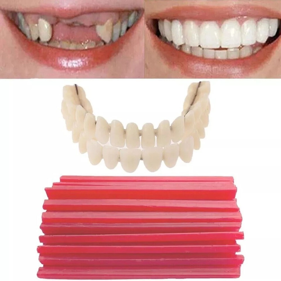 Dentures Fake Teeth DIY Kit Medical Wax DIY Full Denture Kit Repair ...