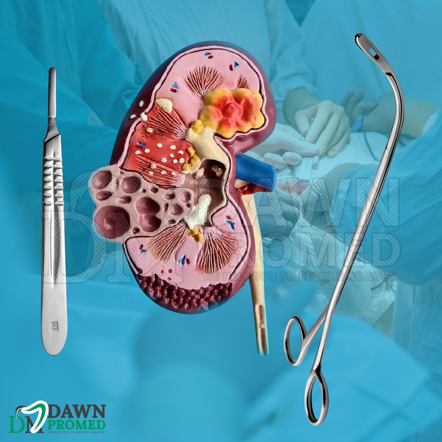 Randall Kidney Stone Forceps 4 Pcs Set 8.25" Half Curved Surgical ...