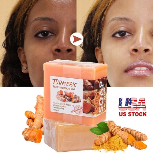 Tumeric Soap Natural Ginger Anti-Acne Dark Spots Scars Removal Skin ...