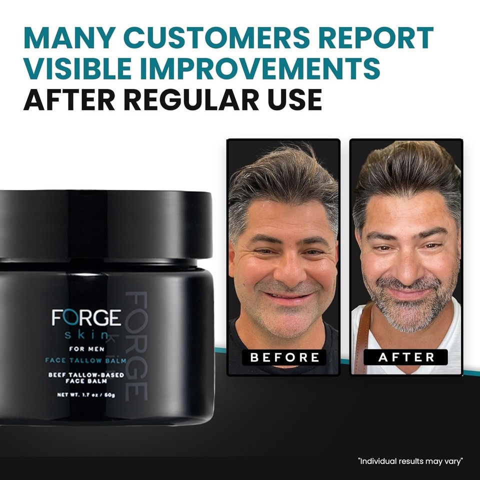 The Forge Skin Beef Tallow Balm for Men – Face Moisturizer & Skincare ...