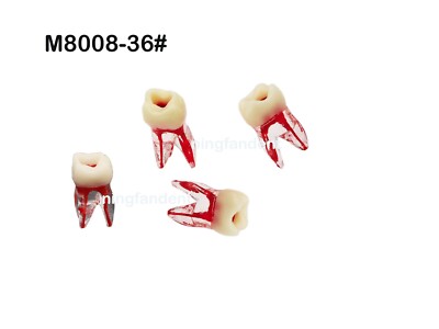 Dental Molar Endo Root Canal Teeth Modle- Study RCT Practice Block Pulp ...