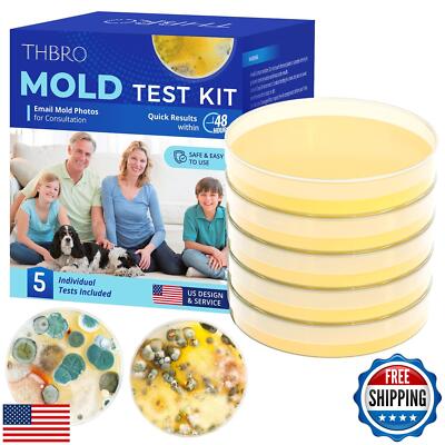 Mold Test Kit for Home Air: DIY Mold Detector with 5 Simple Detection ...