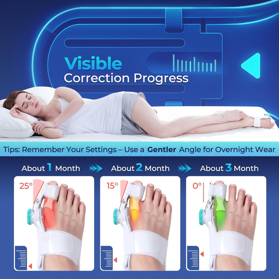 Bunion Corrector for Women Men, Adjustable Toe Brace, Orthopedic Bunion ...