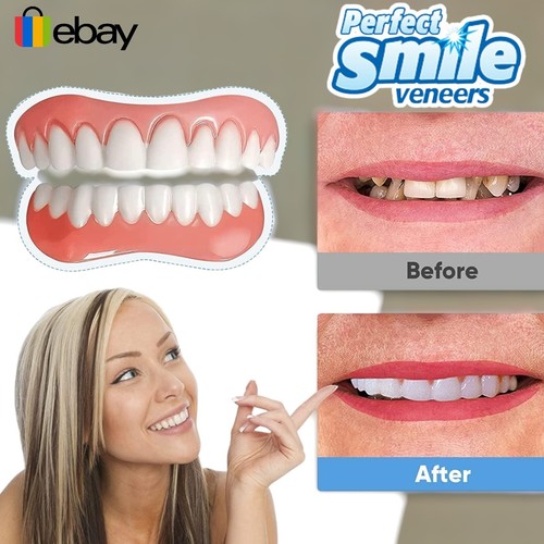 TOP and BOTTOM SMILE PERFECT SNAP VENEERS INSTANT COSMETIC TEETH COVER ...
