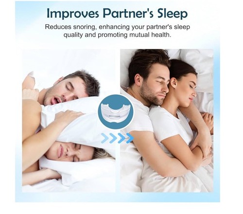 Anti-Snoring Device Mouth Piece - Stop Snore Aid Sleep Apnea Guard ...