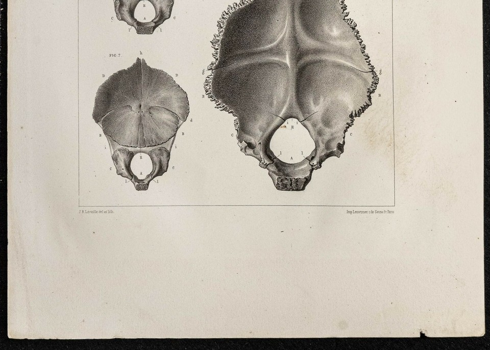 1864 - Occipital Bone Of The Skull - Anatomy Plate - Lithograph ...