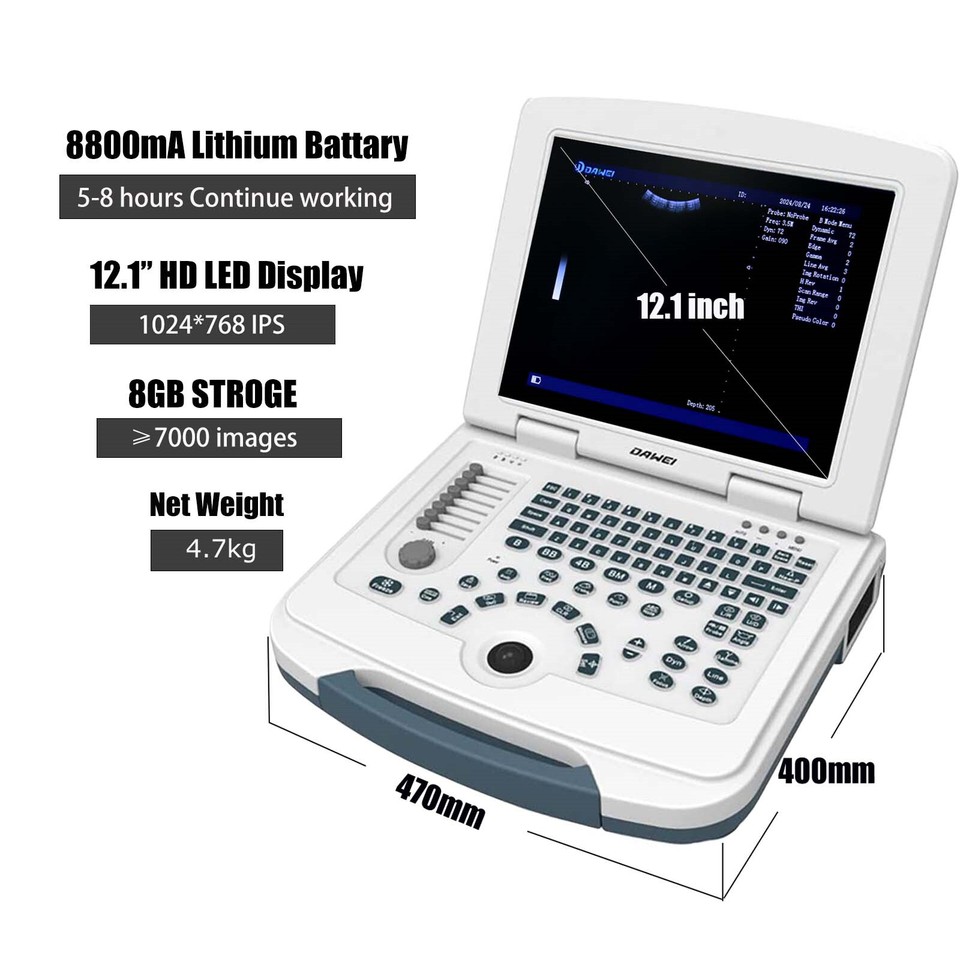 DAWEI Laptop Vet Ultrasound Machine Scanner Convex For Horse,Cow,Large ...