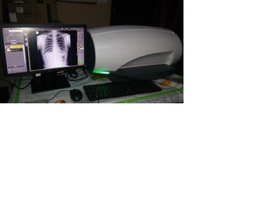 digital xray CR reader carestream 80lbs | eBay