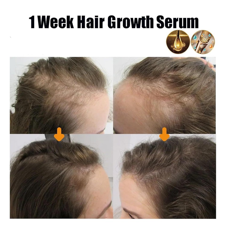 Lidoria Ginger Anti Hair Loss, Ginger Anti Hair Loss 7 Days Oil | eBay