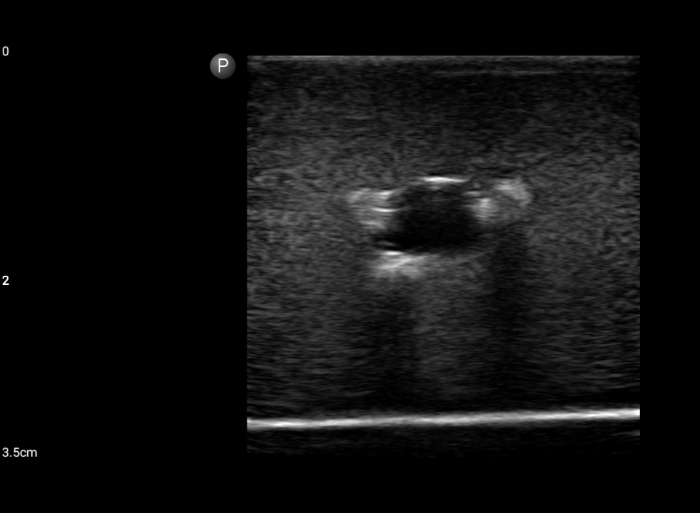 ultrasound phantom nerve bundle model | eBay