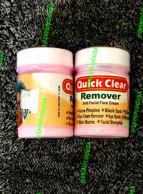 3pcs Quick Clear Face Cream for sunburn, acne / pimples, black spot ...