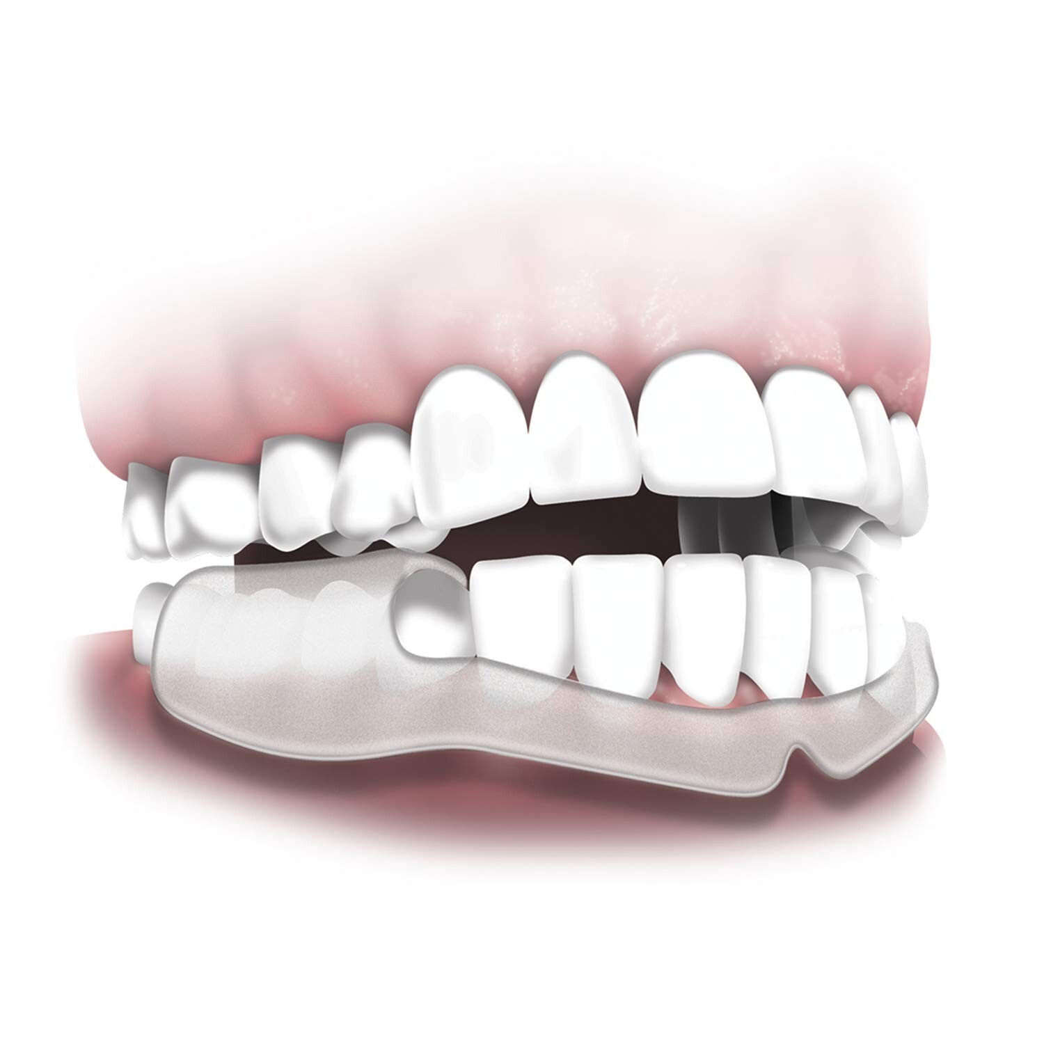 Plackers Mouth Guard Grind No More Dental Night Protector 14 Count for ...