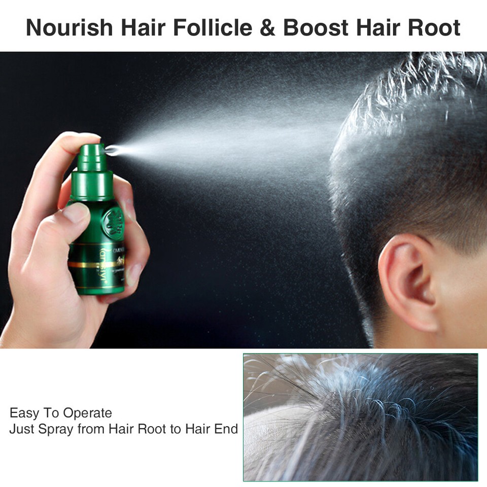 2x Hair Growth Serum Spray Dense Fast Regrowth Ginger Oil Anti Loss ...