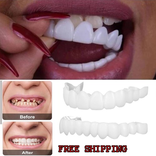 Smile Snap On Upper＆Bottom Set False Teeth Denture Veneers Dental Tooth ...
