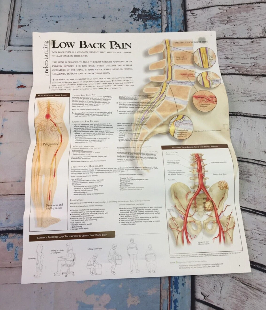 Lumbar Pain Chart