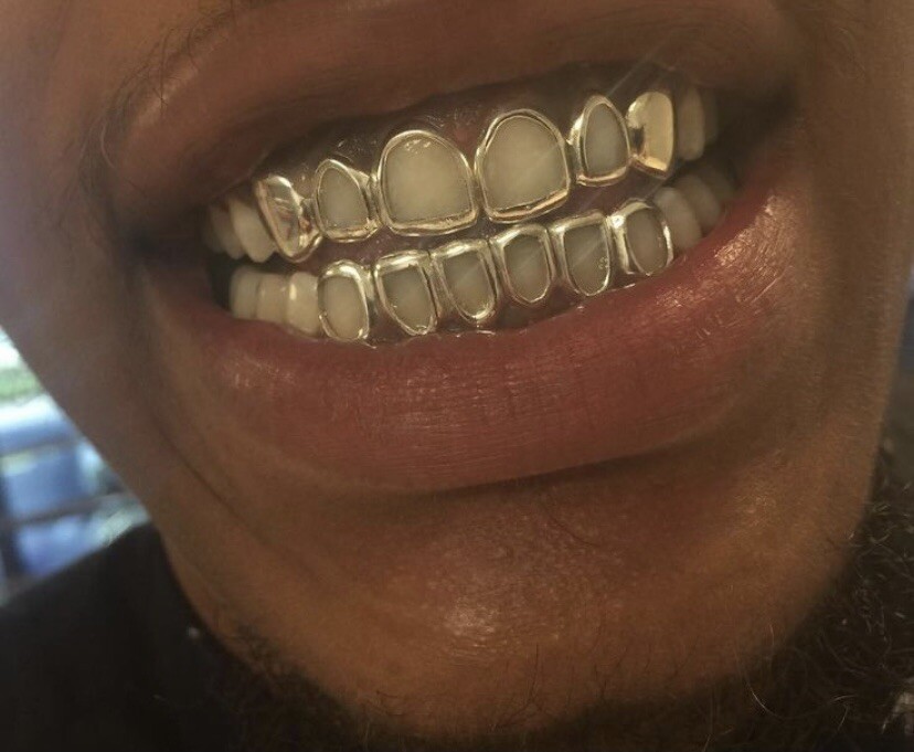 Silver Fronts Teeth