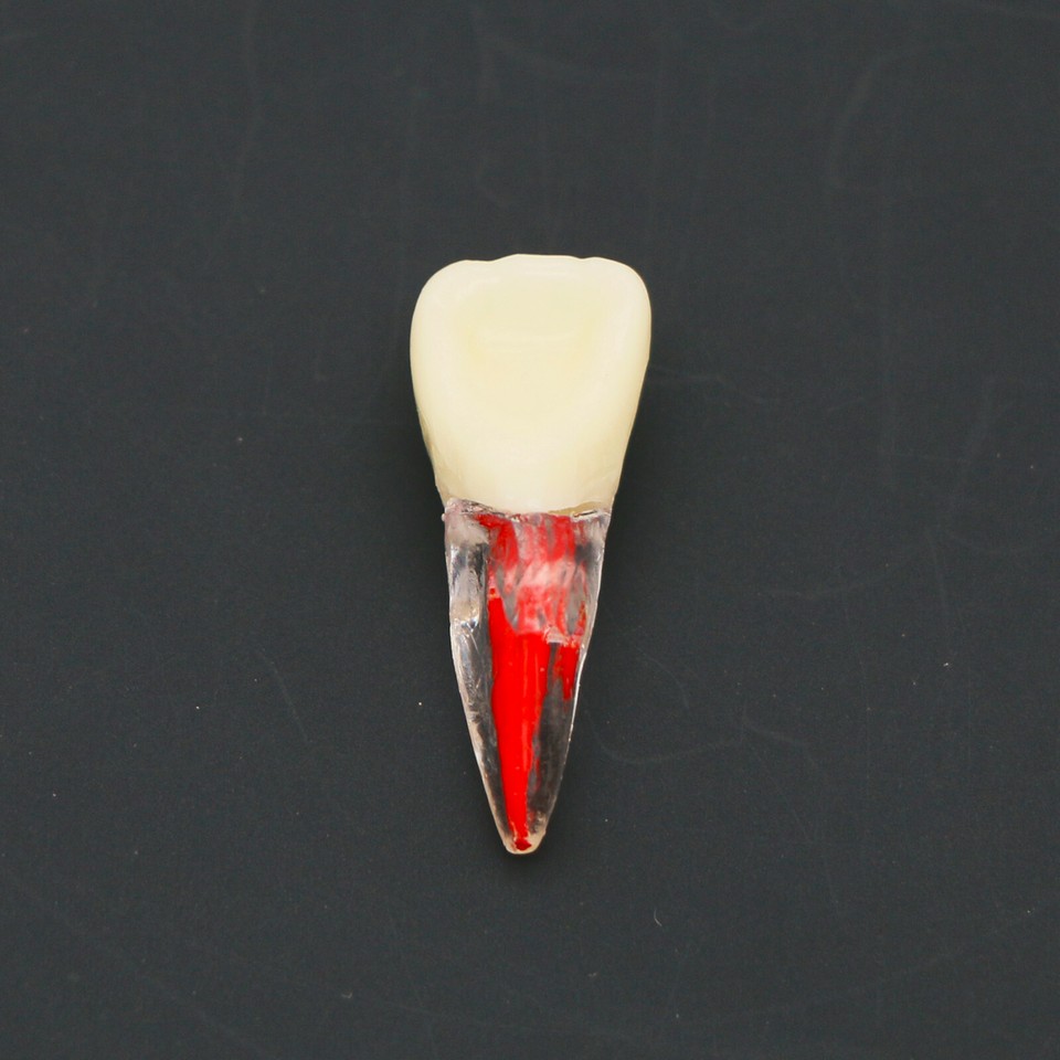 5Pcs Dental Endodontic Root Canal RCT Practice Pulp Cavity Endo Teeth ...