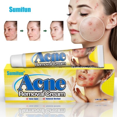 30g Acne Removal Cream Pimple Pits Pustule Deep Cleaning Face Repair ...
