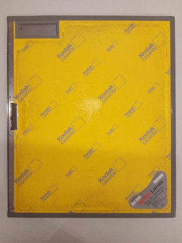 Kodak Lanex Regular Screens X-OMAT 43 / 35.5 cm ~ 16.9 / 14 " | eBay