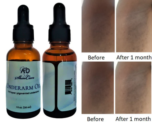 Dark underarms, lightening oil, natural deodorant, underarm detox oil ...