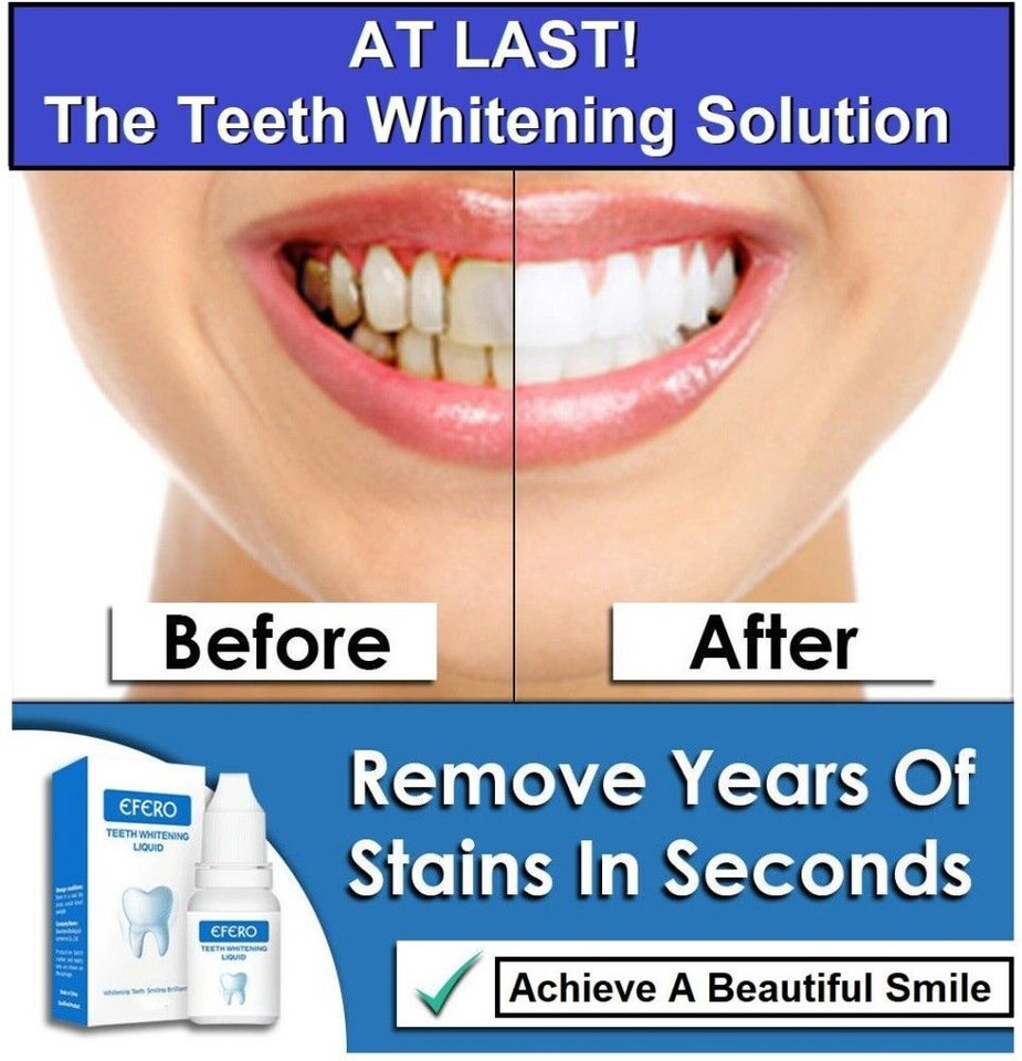 3PACK TEETH WHITENING LIQUID GEL, STAIN REMOVER TOOTH WHITENING ...