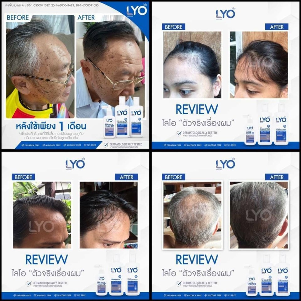 LYO Hair Tonic Shampoo Conditioner Reduce Hair Loss Growth Fast Beard ...