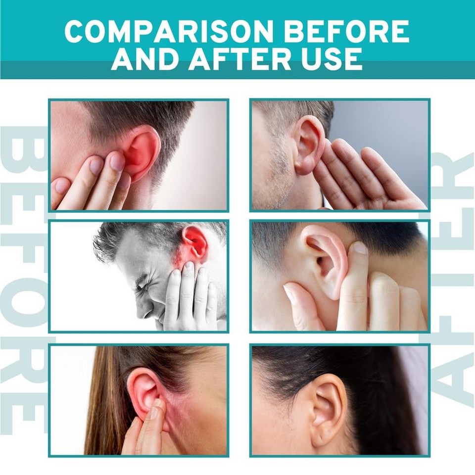 Ear Drops Clear Ear Elixir Tinnitus Inner Ear Obstruction Relief ...