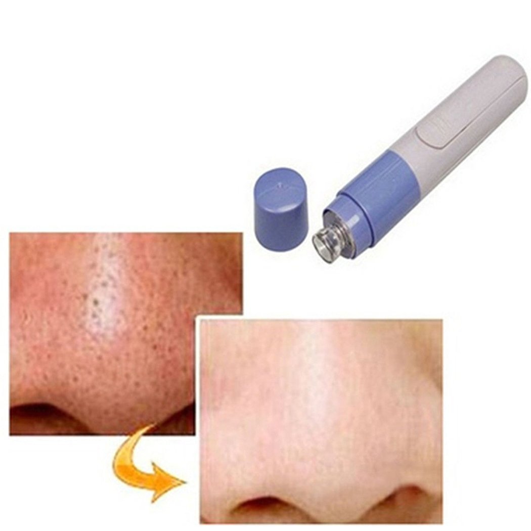 Electric Skin Sucker Acne Blackhead Remover Facial Pore Cleanser Pimple ...