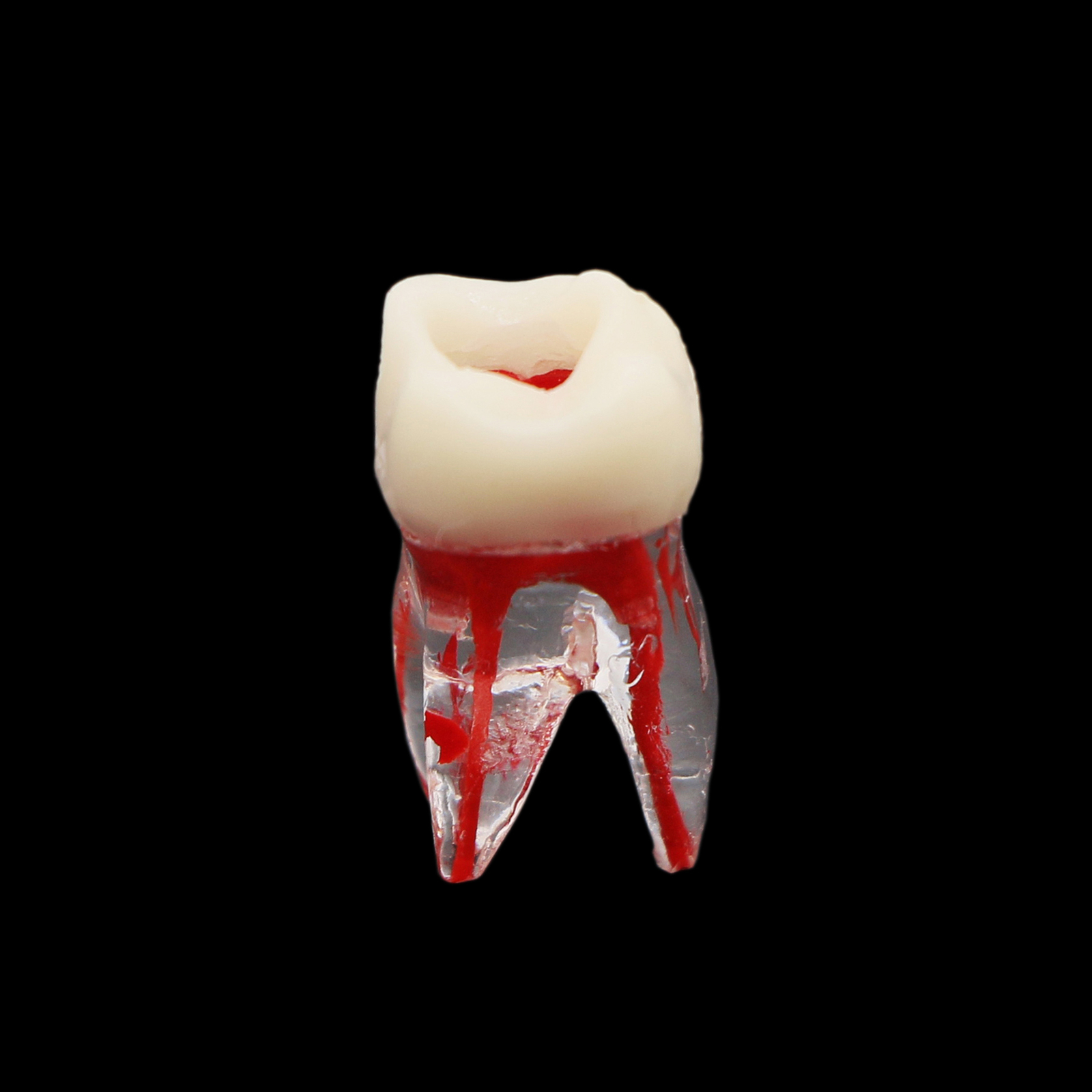 Dental Endodontics Root Canal Study Model for Block Pulp Cavity RCT ...