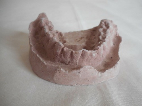 Vintage Cast Dental Teeth Mold Tooth Castings Medical Oddity #9 | eBay