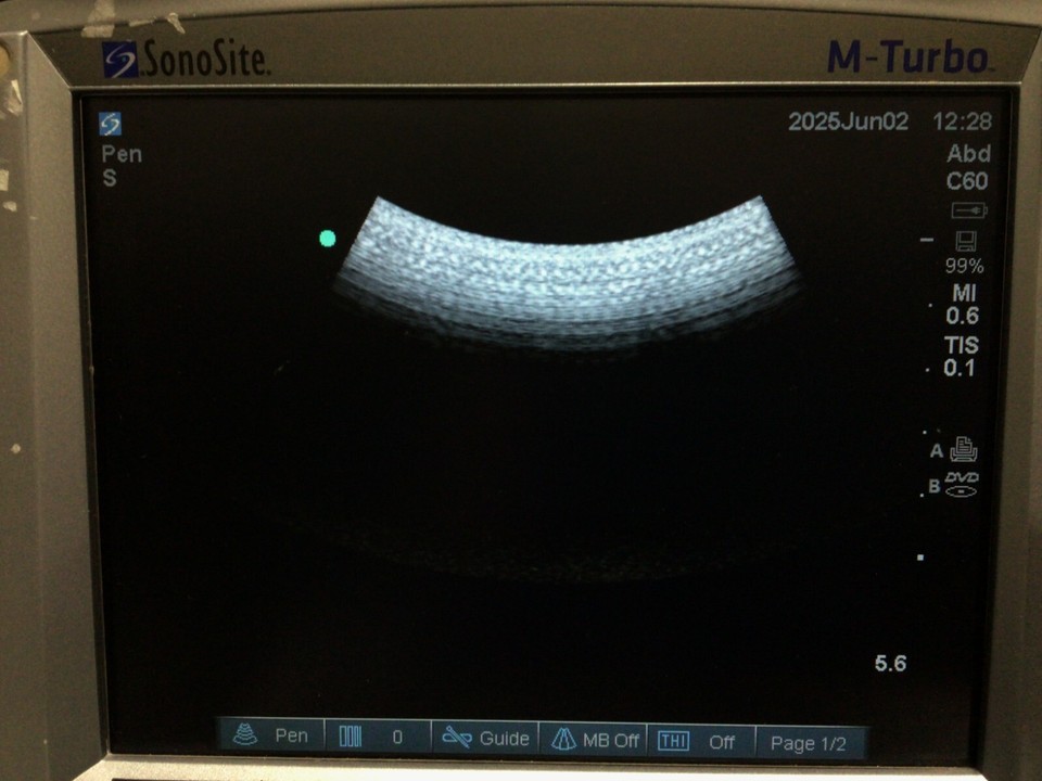 SonoSite C60x/5-2 MHz Convex Array Ultrasound Probe Great Condition! | eBay