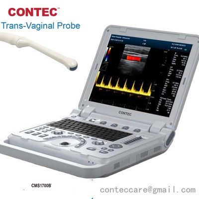 Imaging & Aesthetics Equipment - Transrectal Probe