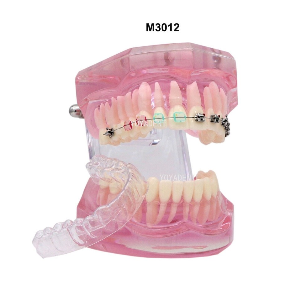 Dental Orthodontic Teeth Model With Metal Ceramic Brackets Tube Hawley ...