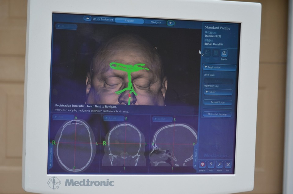 Medtronic Fusion ENT Navigation Image Guidance System | eBay