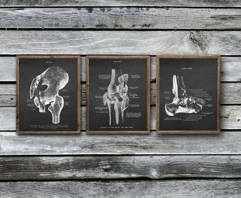 Anatomy Decor Poster set of 3 Unframed Posters Hip Knee Ankle Joints ...