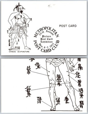 Chinese Acupuncture Diagram Postcard | eBay