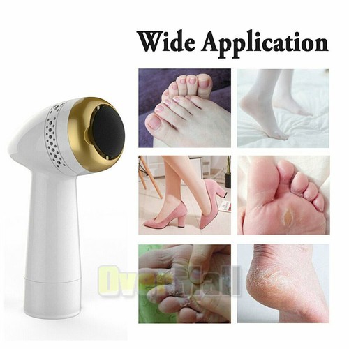 Powerful 3000RPM Electric Pedicure Foot File Sander Callus Feet Grinder ...