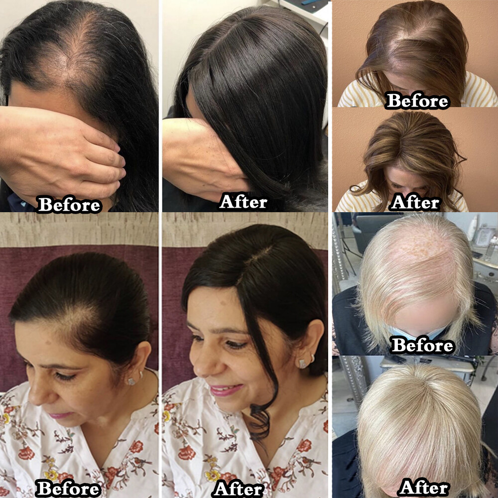 Women Remy Topper Hairpiece Clip In Real Human Hair Silk Base Toupee ...