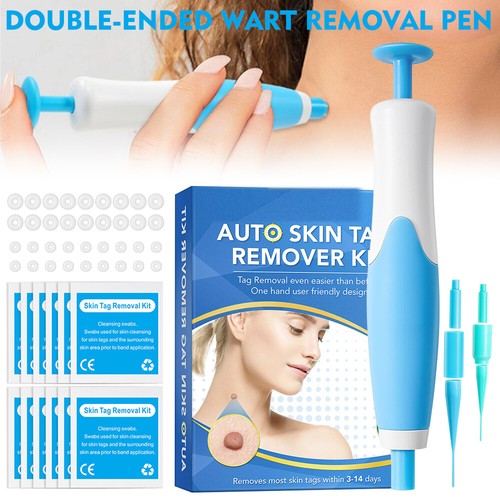 2 in 1 Natural Painless Auto Skin Tag Removal kit Skin tag bands ...