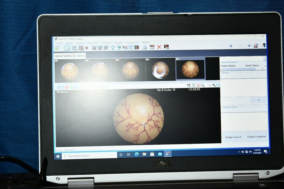 Canon CR-2 Retinal Camera with dell laptop windows 10 with Canon So | eBay